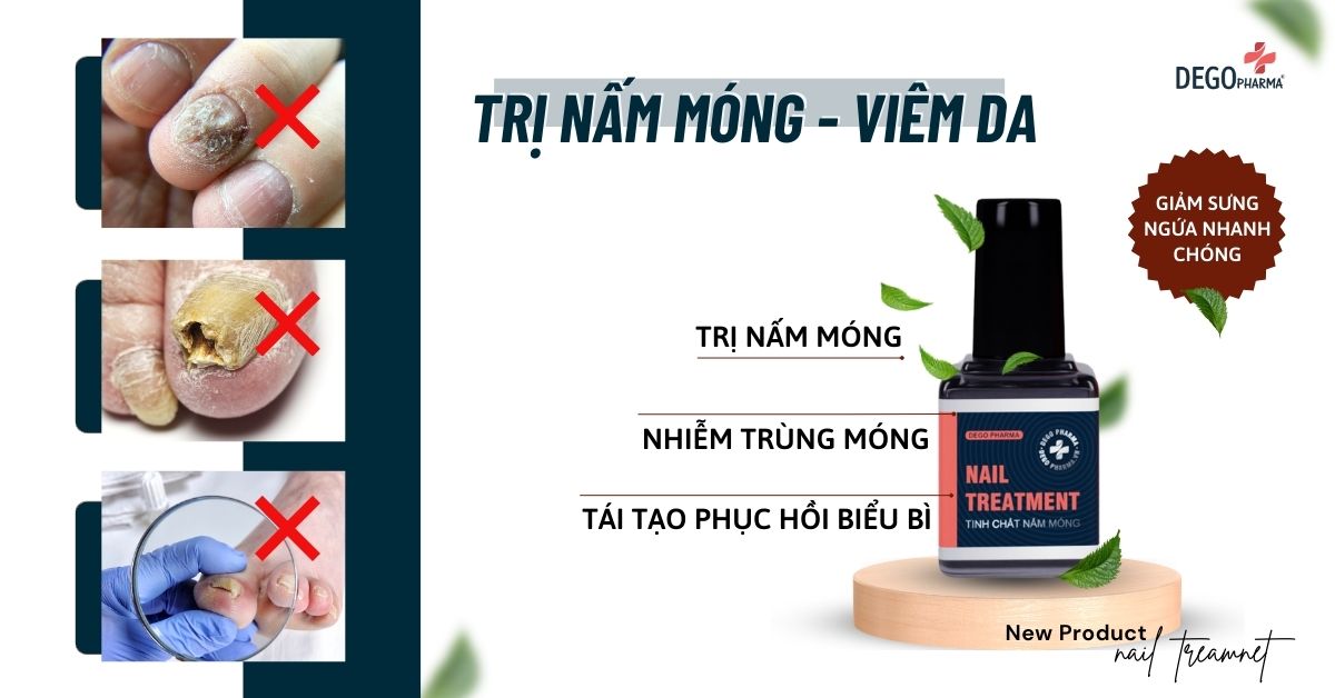 Review viên uống tăng chiều cao GH Creation tất tần tật từ A-Z ...